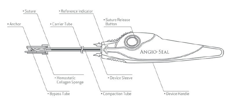 Angio-Seal™ Evolution™ Vascular Closure Device